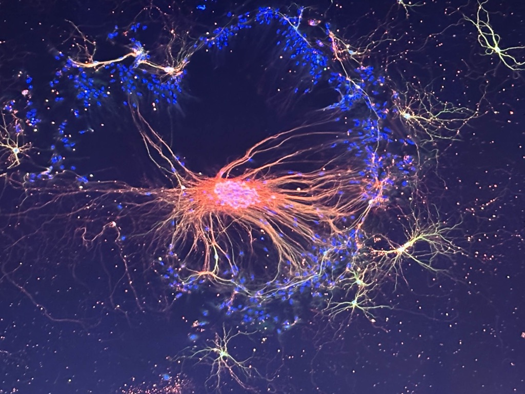 SWOSU Day 11: Wait for It - SSP International